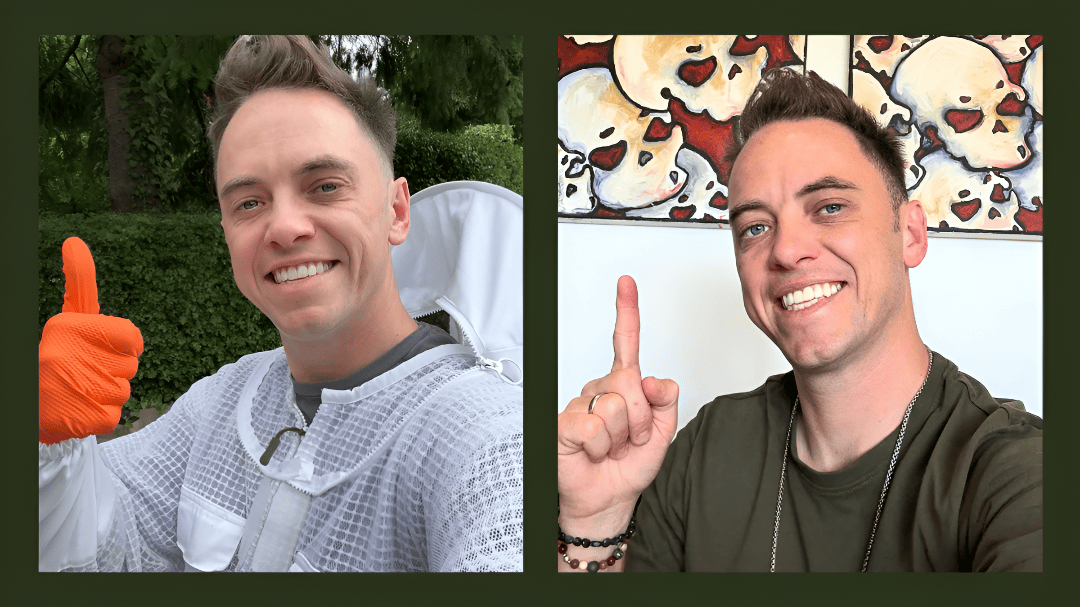 Lee Burkhill: Childhood, Partner, Husband, Wikipedia and Life Story